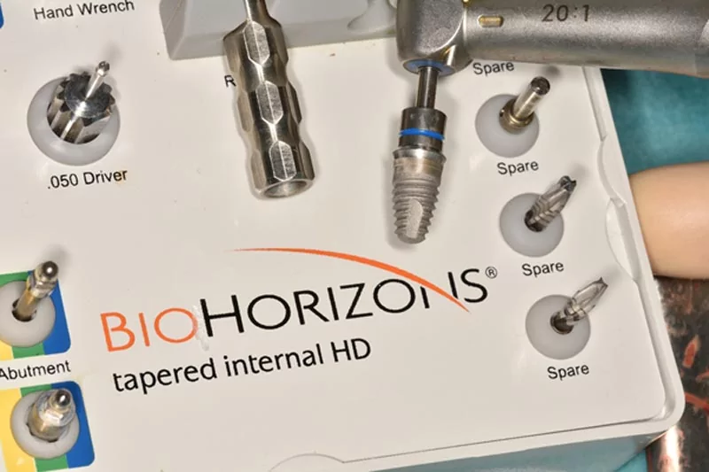 The Implant Hub from Biohorizons