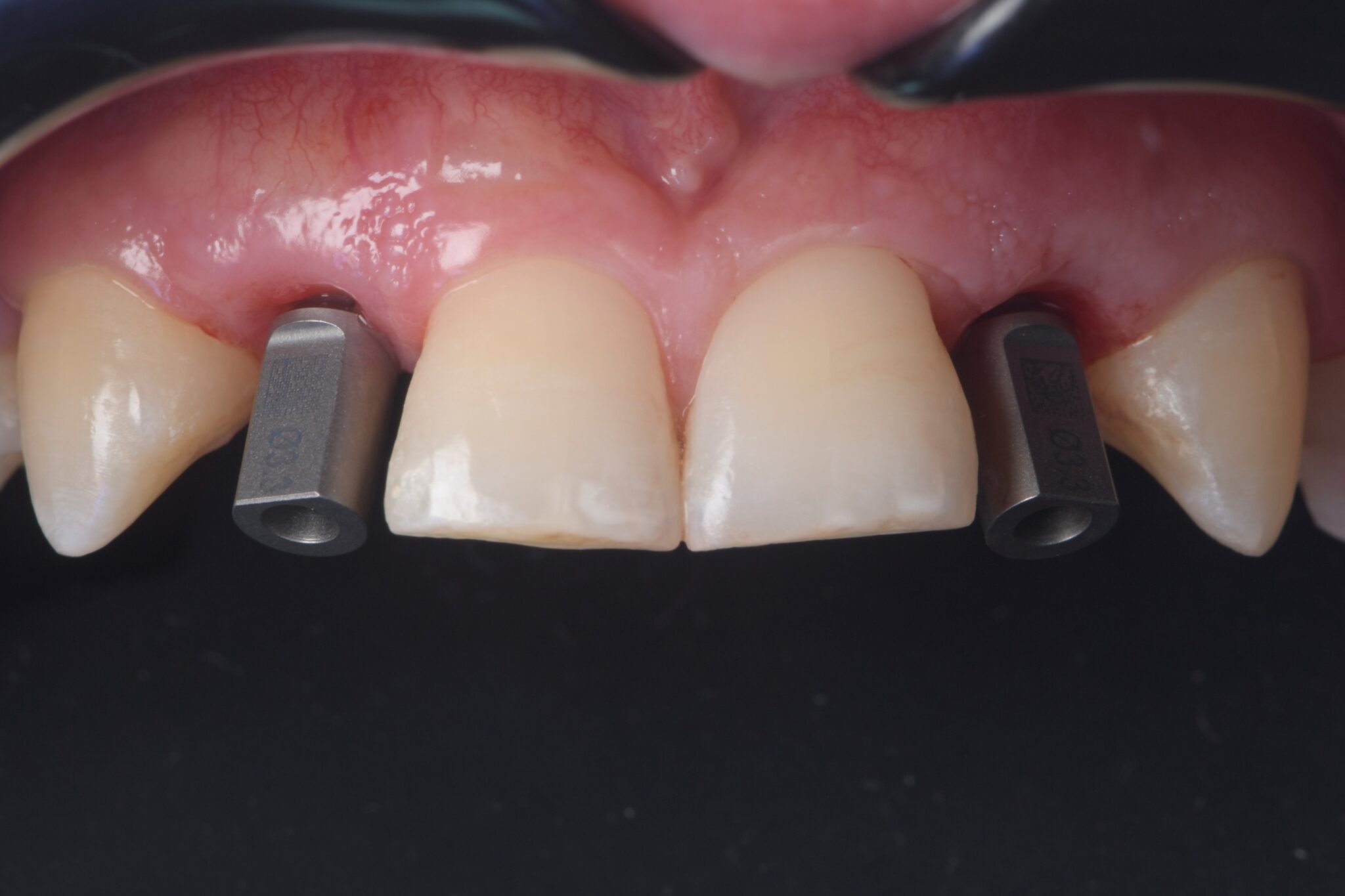 Home - The Implant Hub from Biohorizons