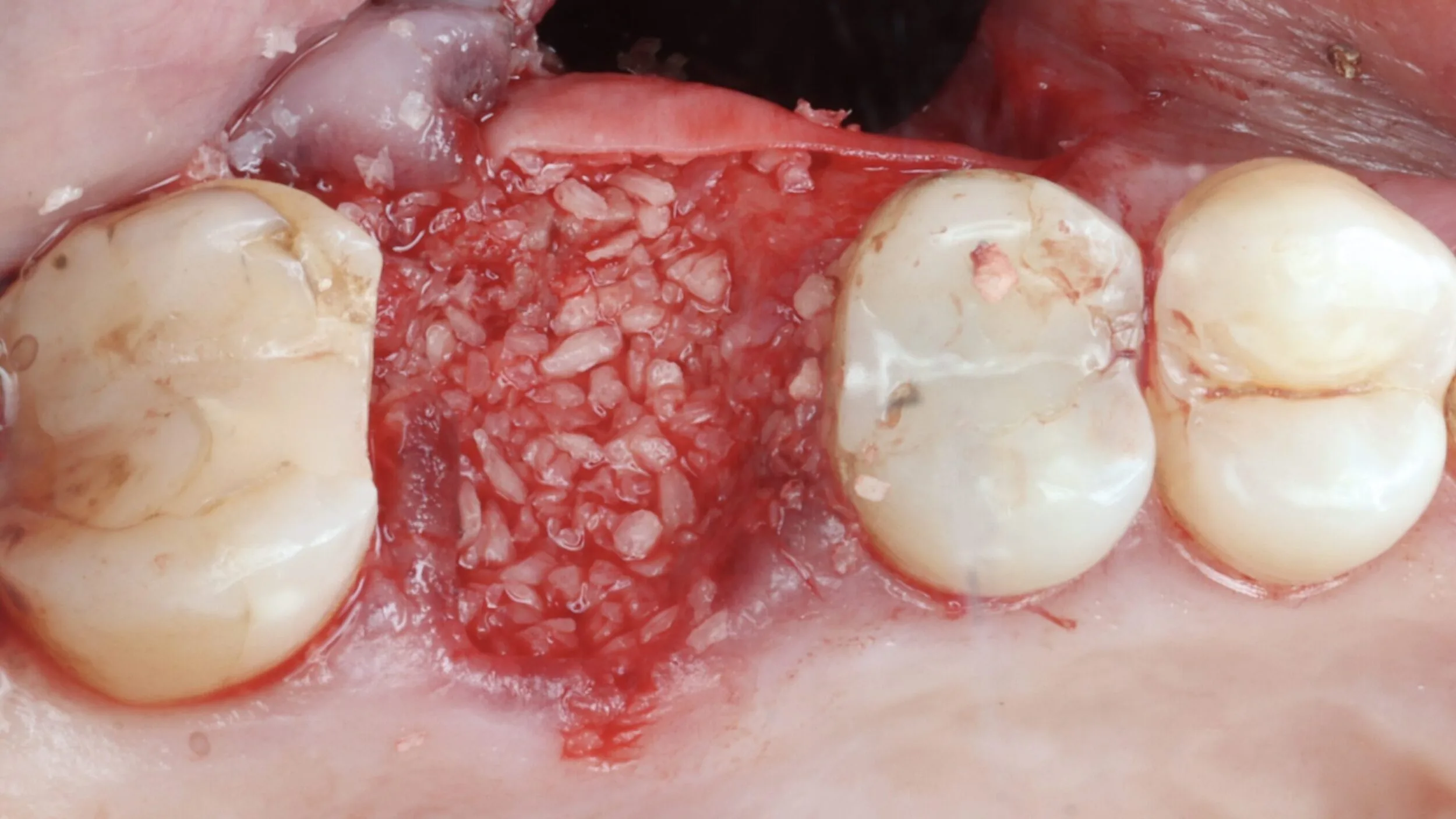 Home - The Implant Hub from Biohorizons