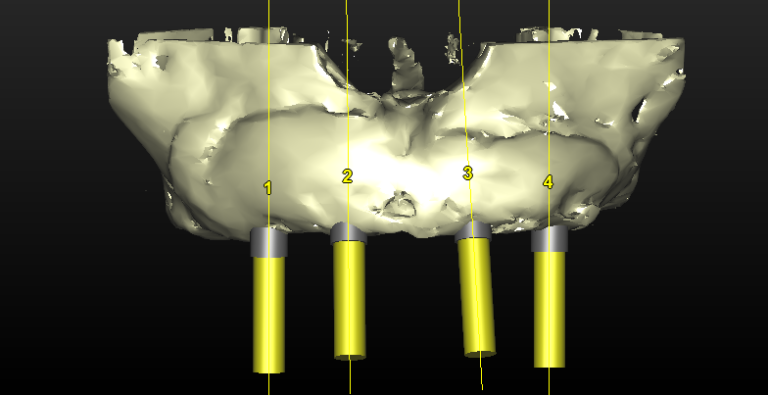 Home - The Implant Hub from Biohorizons
